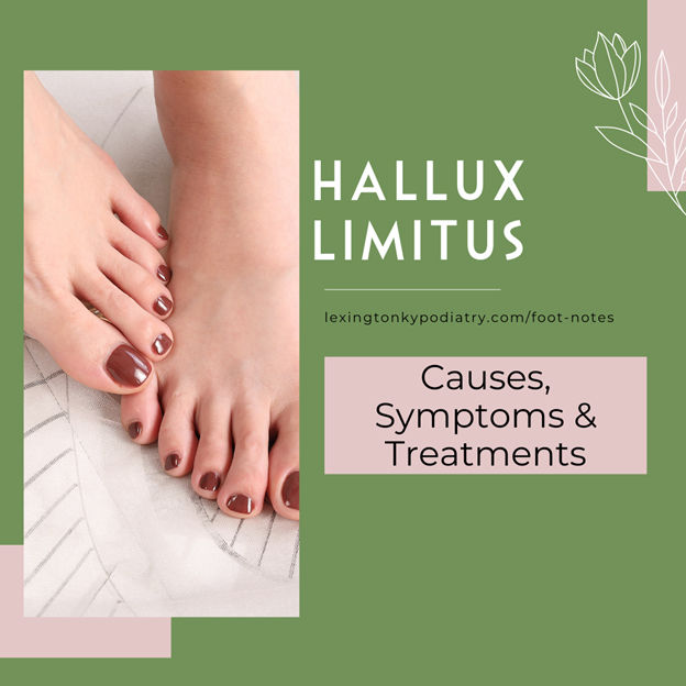 Hallux Limitus: Symptoms, Causes and Treatments | Hallux Limitus ...